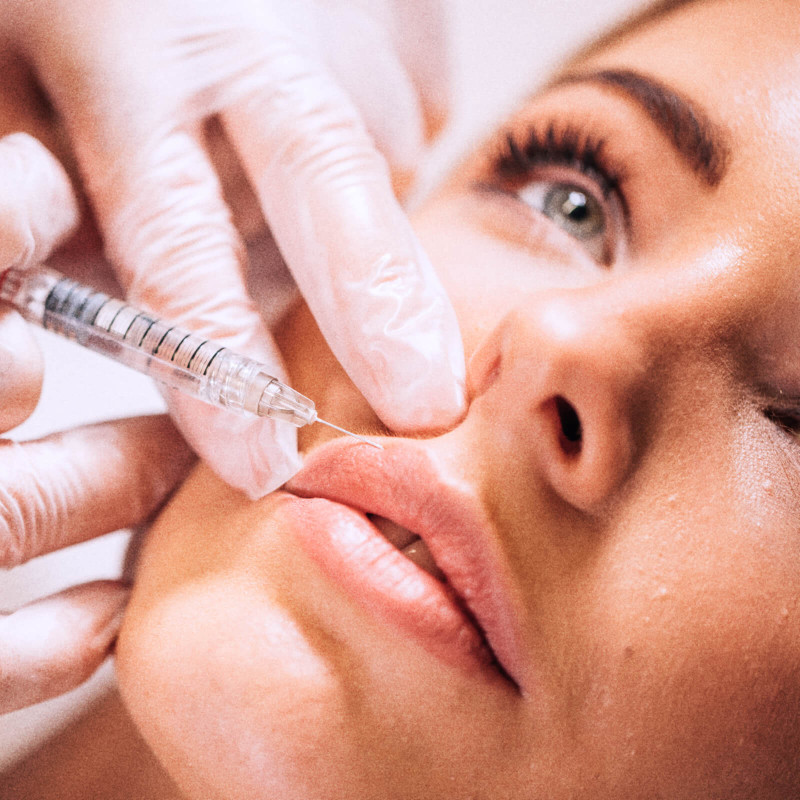 Lip Fillers Belfast | From £180 - Natural Results & Zero Pain | Array