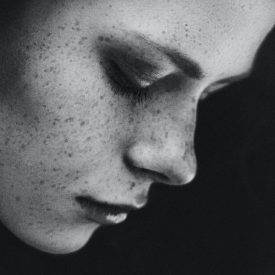 Botox & Dermal Filler Belfast From £120 | Array Aesthetics